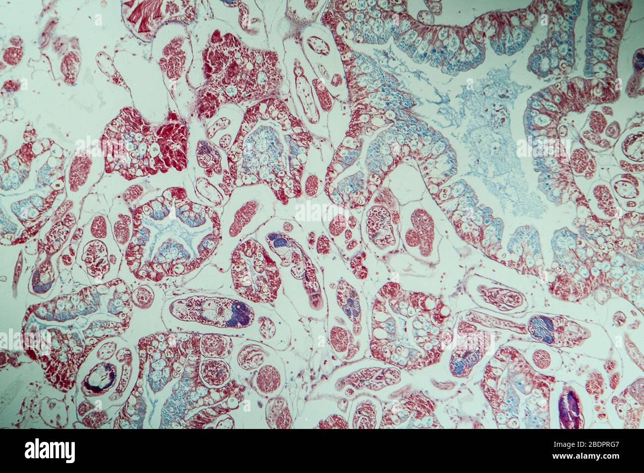Infection with liver fluke tissue section 100x Stock Photo - Alamy