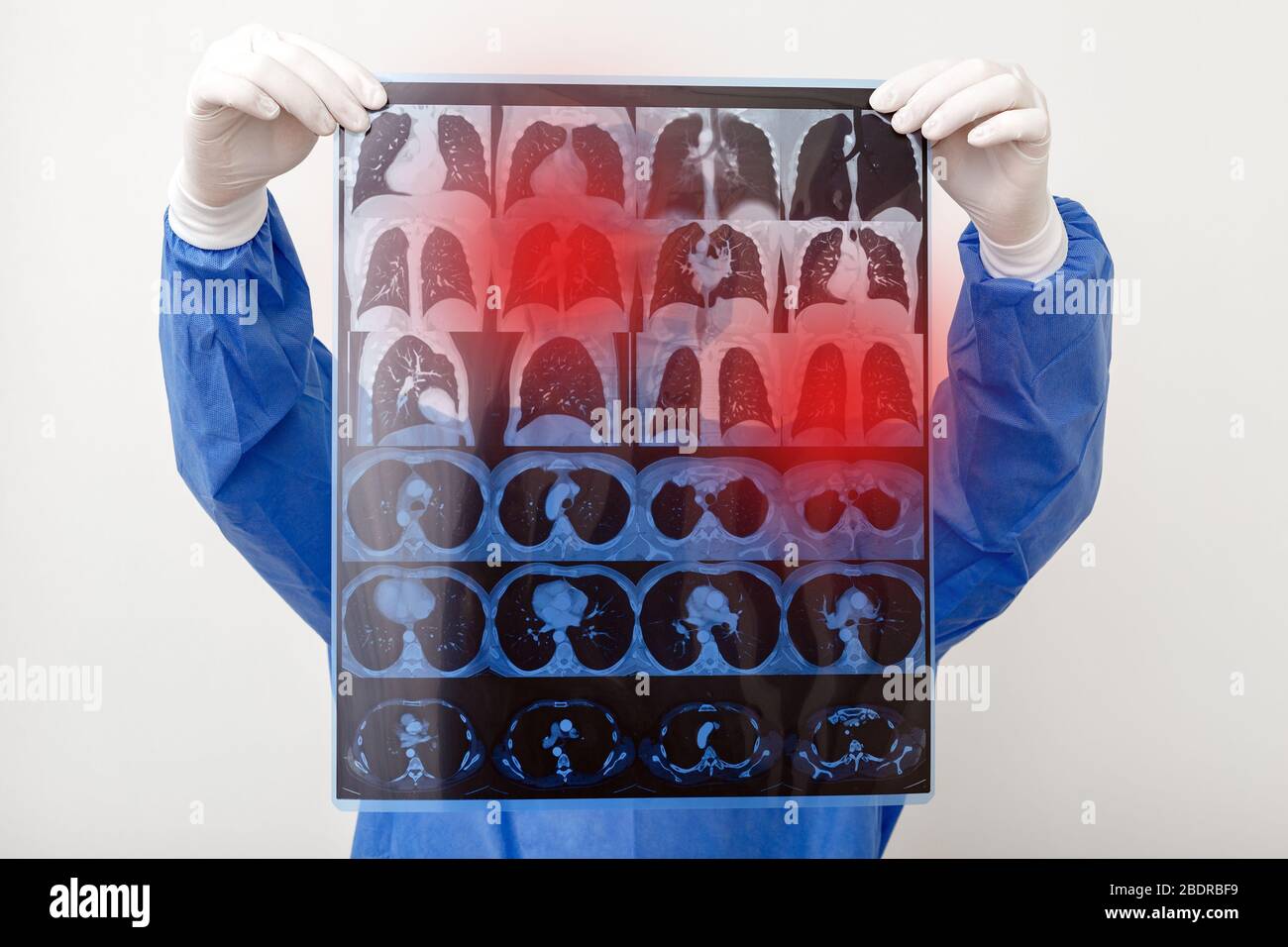 MRI lungs scan in Doctor hands. Surgeon in protective uniform check up ...