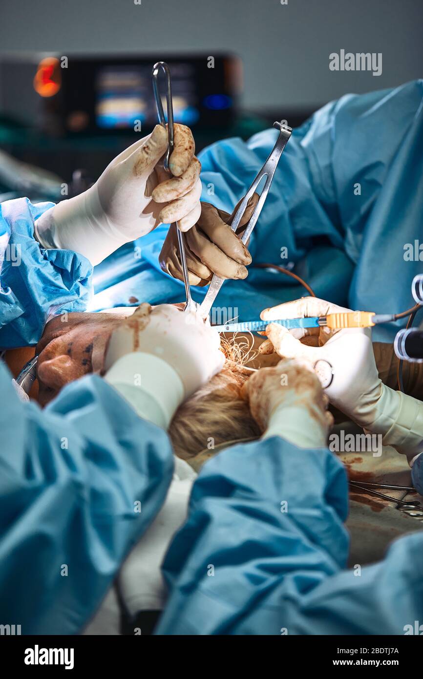 Operation contour facelift. A real operation, a team of surgeons ...