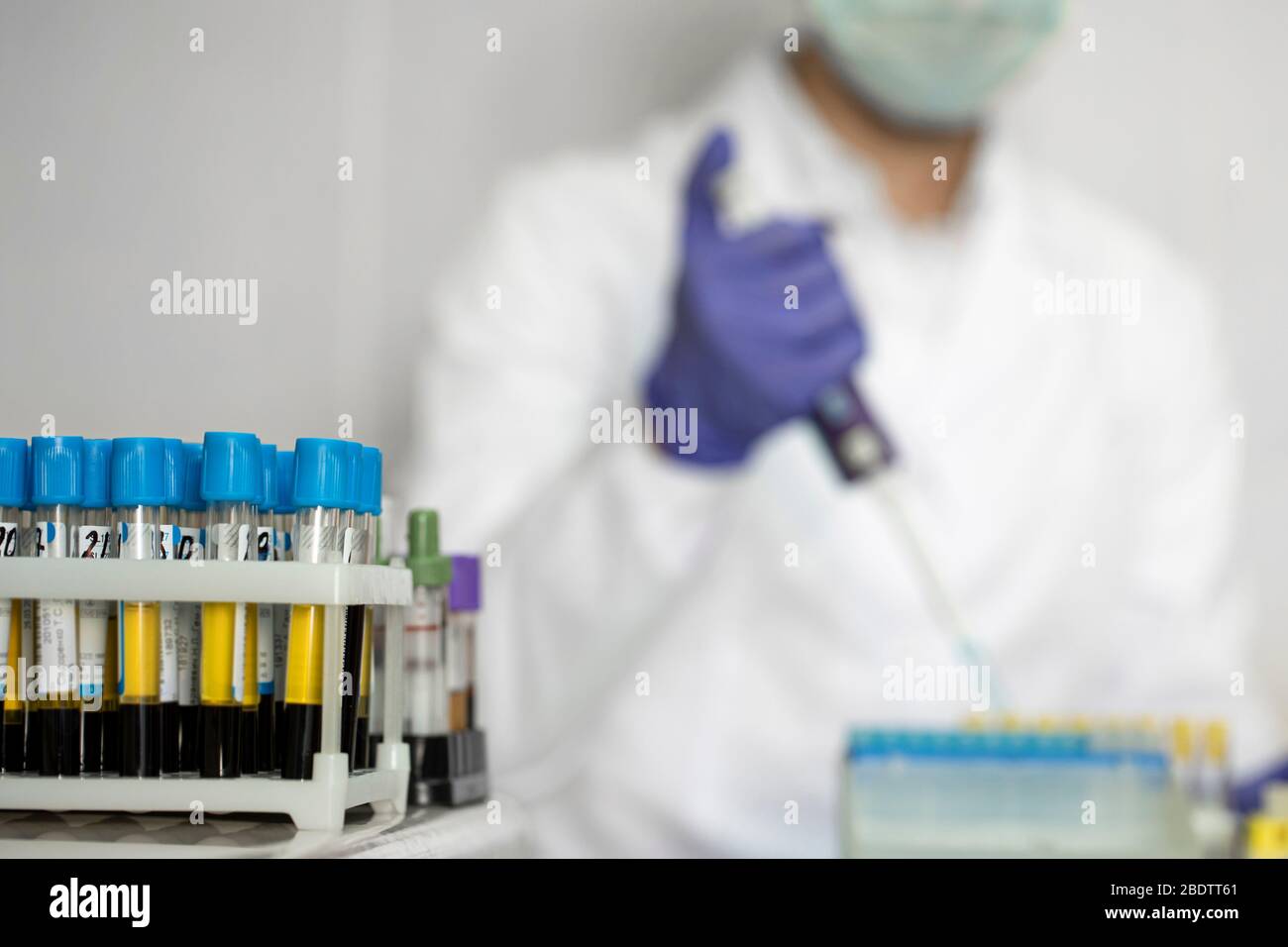 Blood samples on tray hi-res stock photography and images - Alamy