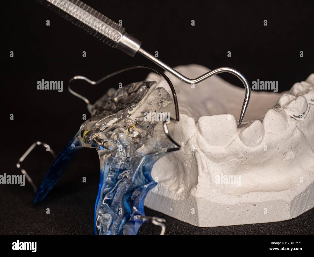 Temporary retainers on white plaster cast. Retainers are important ...