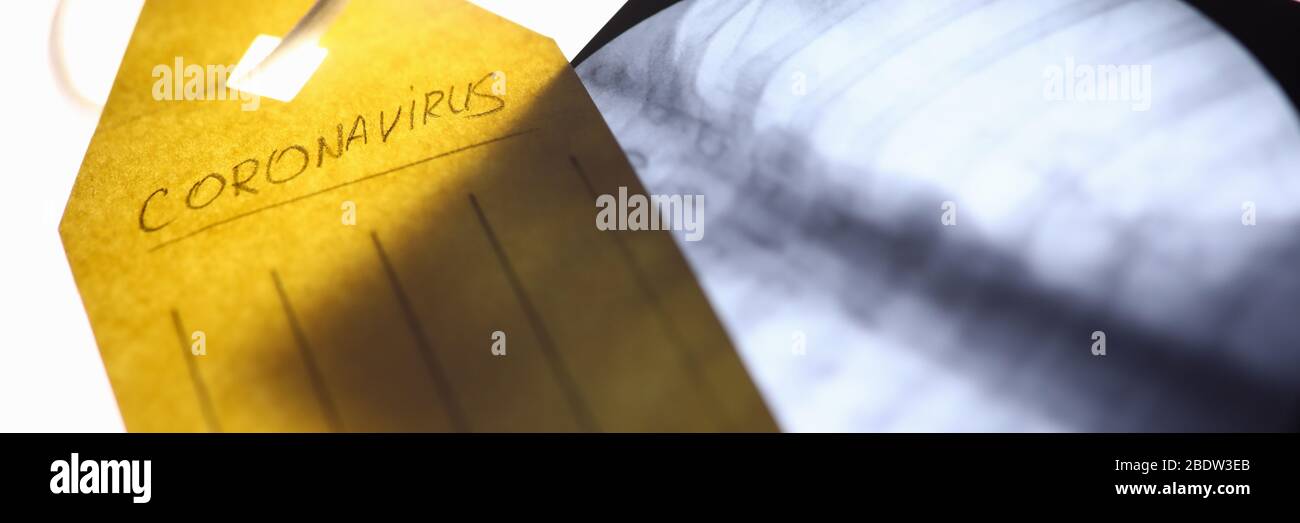 Photograph lung x-ray with tag from carrot Stock Photo - Alamy