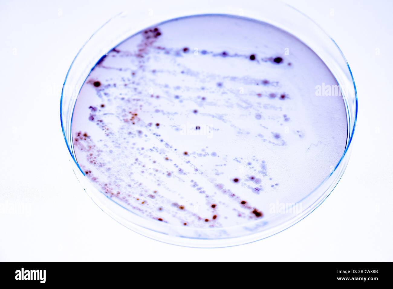 Growing Bacteria in Petri Dishes on agar gel Scientific experiment ...
