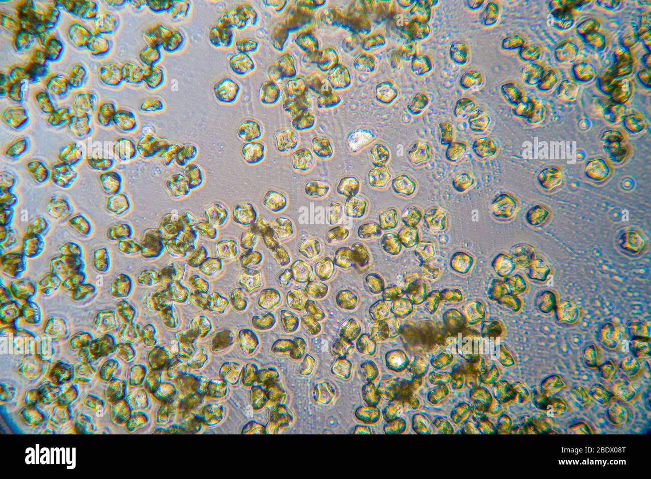 Pathogens magnified by a microscope Stock Photo - Alamy