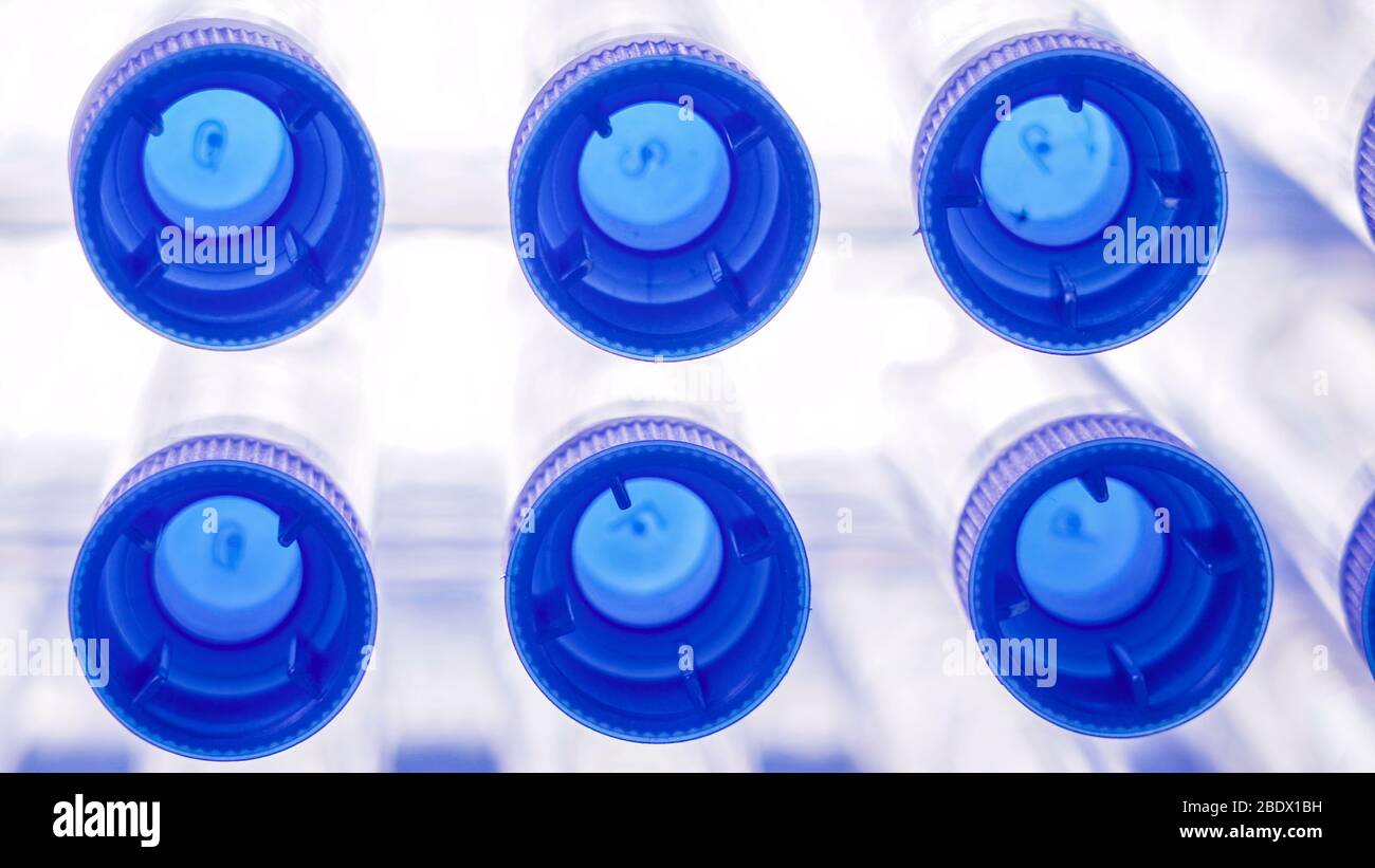 Closer look of the blue caps of the tubes on the table glass inside the ...