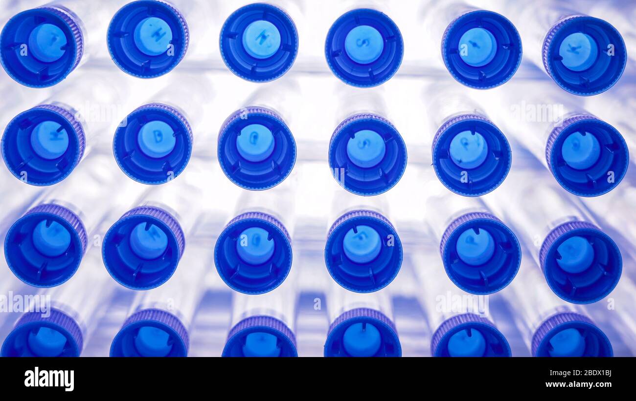 Lots of blue caps of the tubes in the glass table inside the laboratory ...