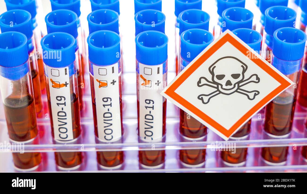 The hazard sign on the positive test samples of coronavirus inside the ...