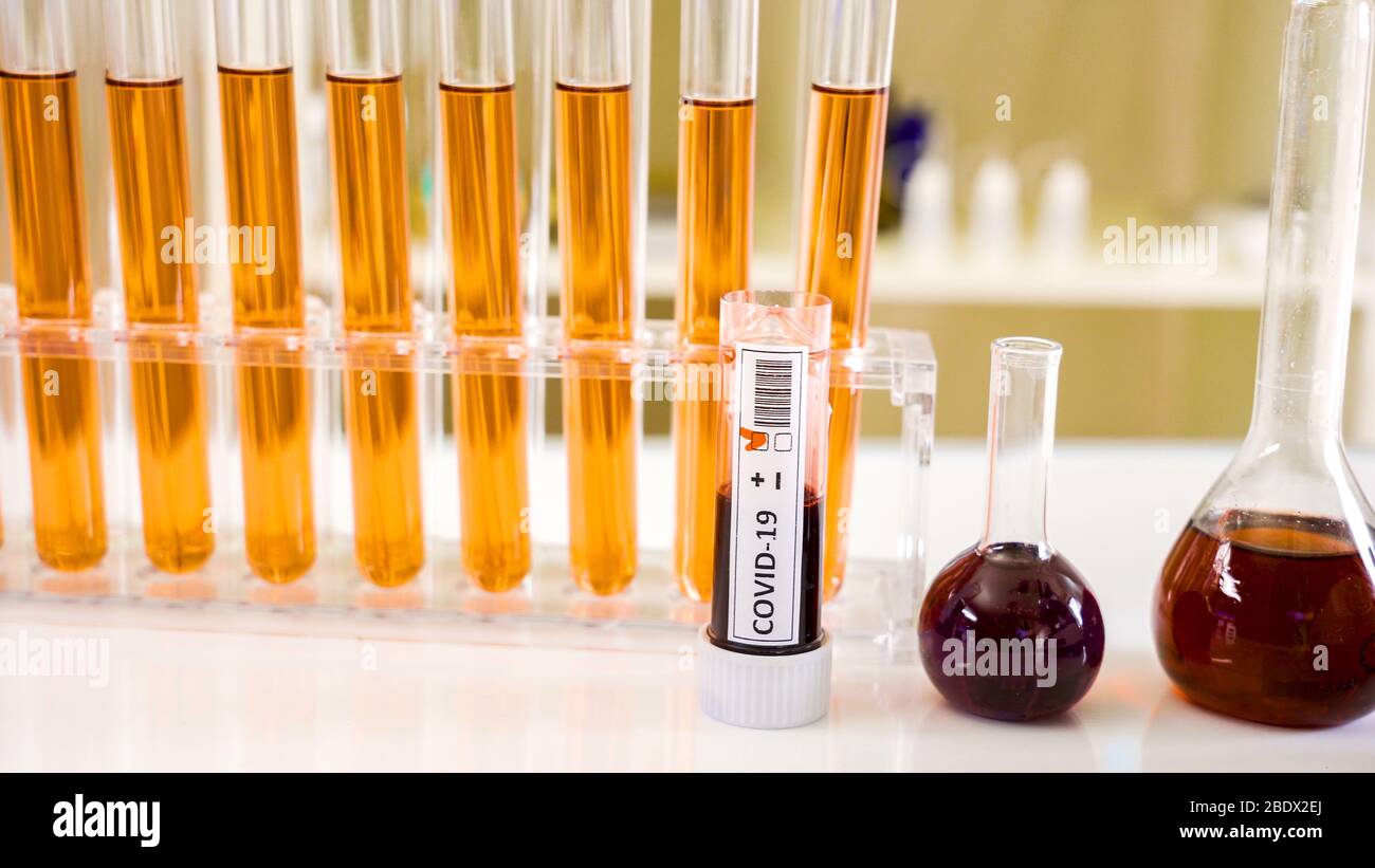Beakers and long test tubes with the small blood sample kit with Covid ...