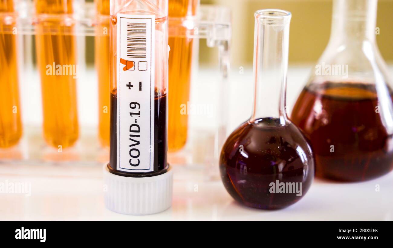 A closer look of the small sample kit with positive mark for ...