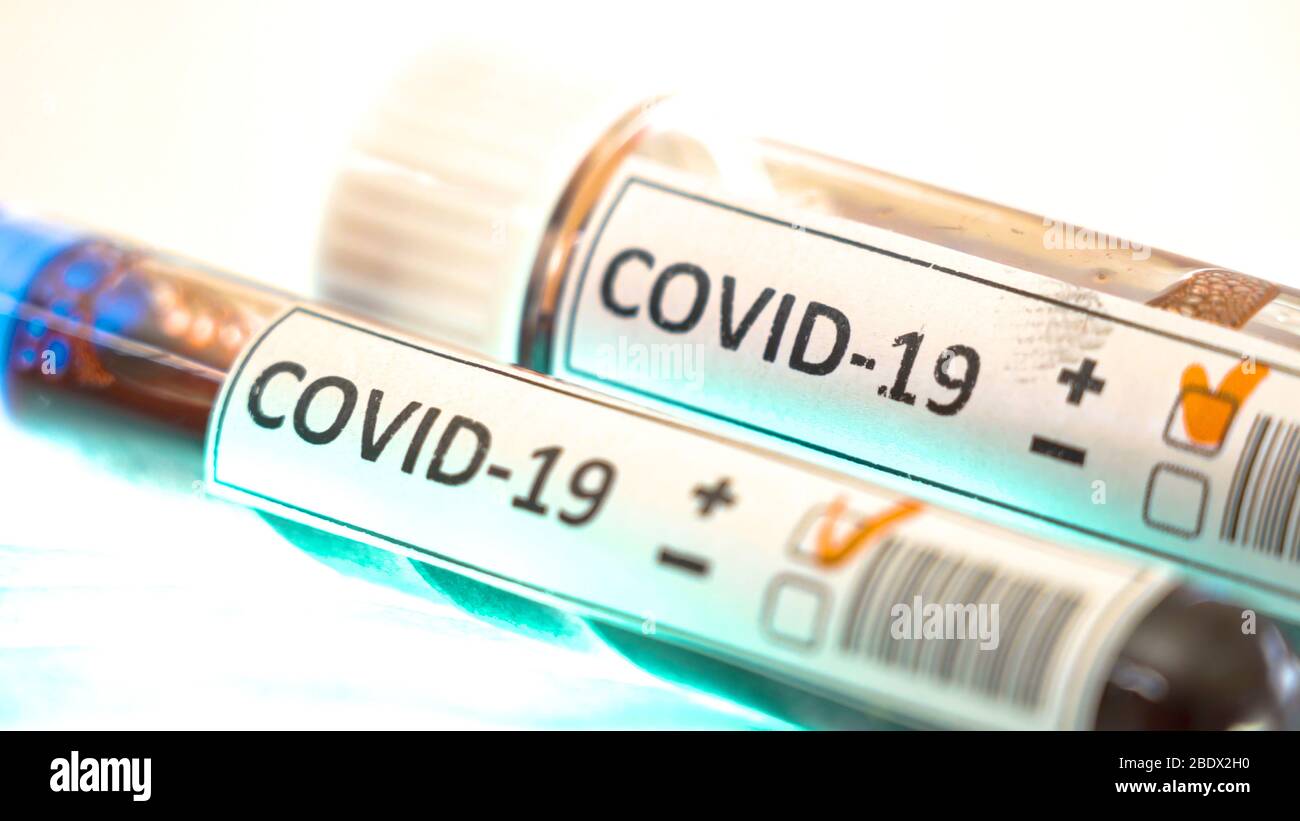 Closer look of the two positive kits for coronavirus with the blood ...