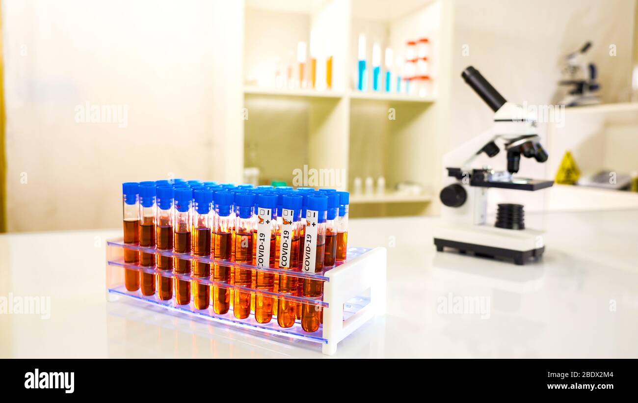 Three laboratory test tubes hi-res stock photography and images - Alamy