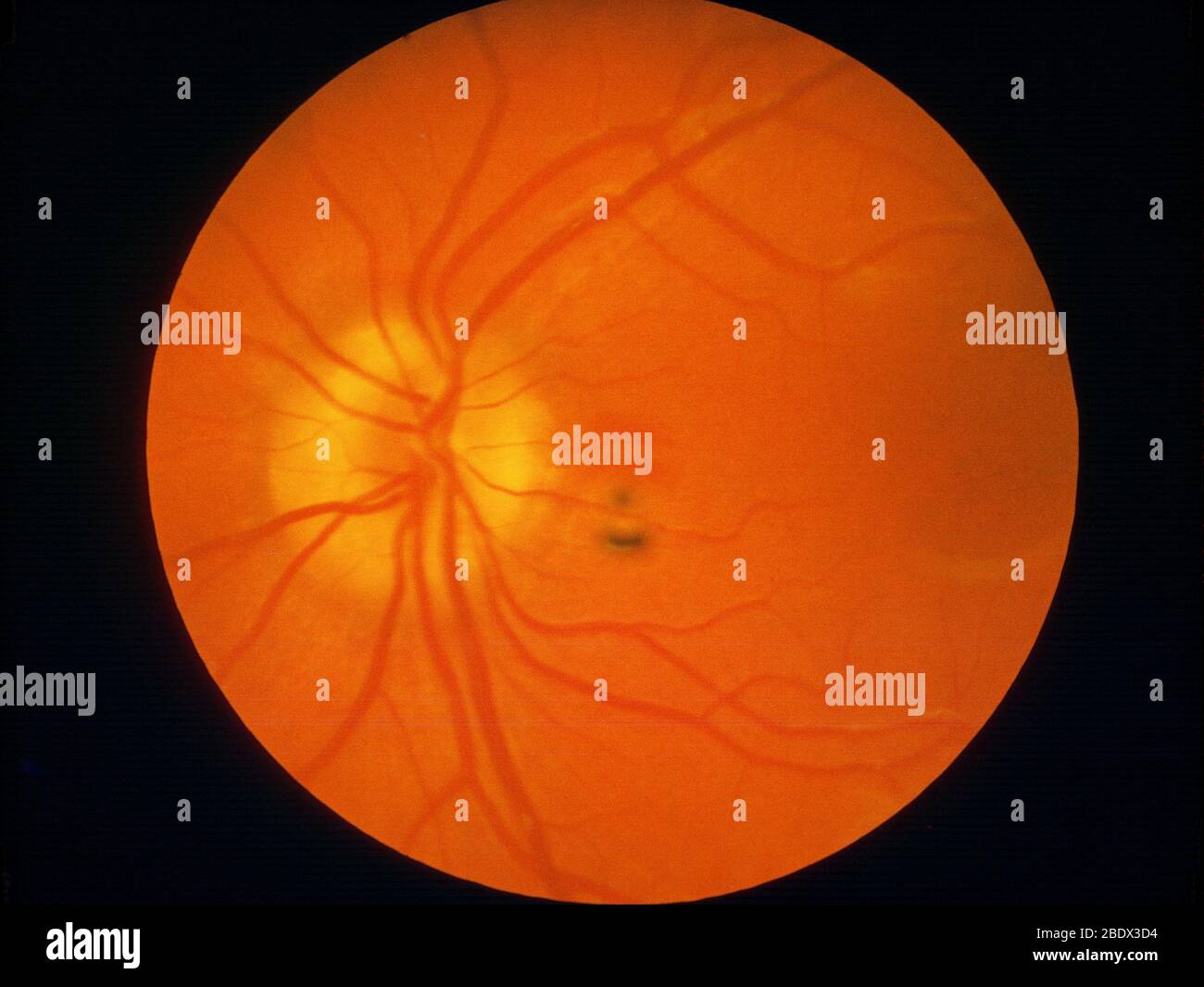 Fundus eye hi-res stock photography and images - Alamy