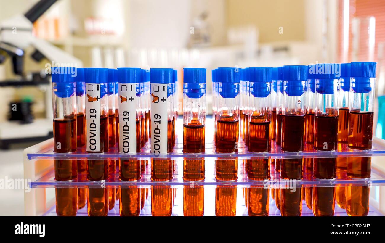 A view inside the laboratory with sample kits for COVID-19 coronavirus ...