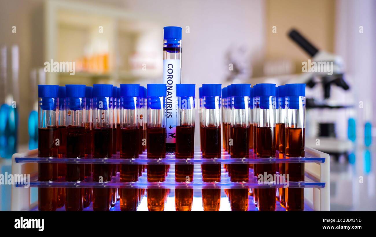 A rack of test tubes with the sample kits of the COVID-19 coronavirus ...