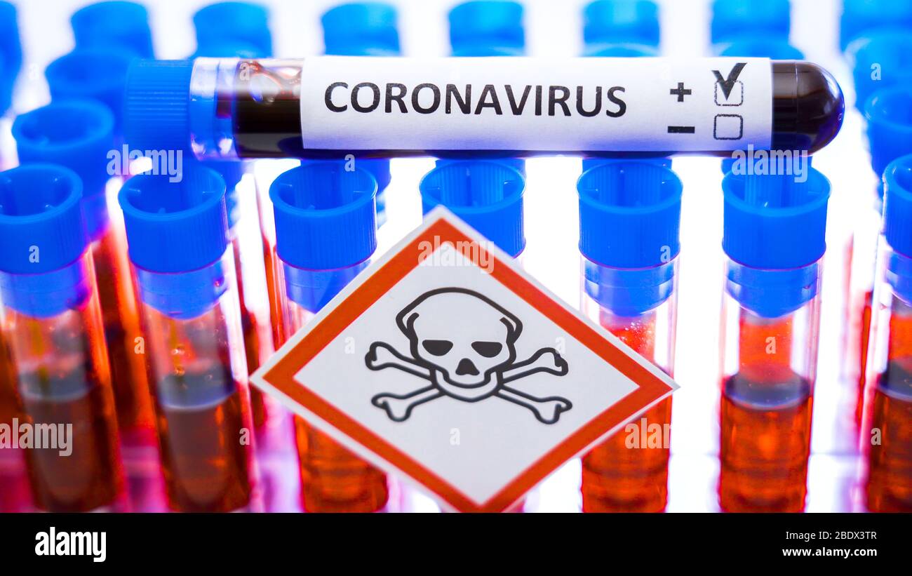 The hazard sign on the test tube rack with the sample for COVID-19 ...