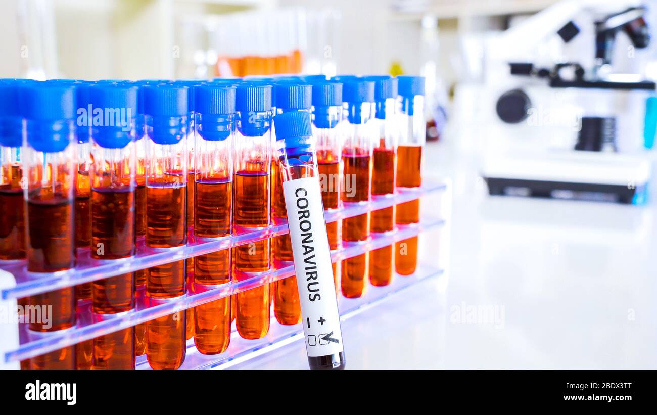 The test tube rack filled with samples for COVID-19 coronavirus with ...