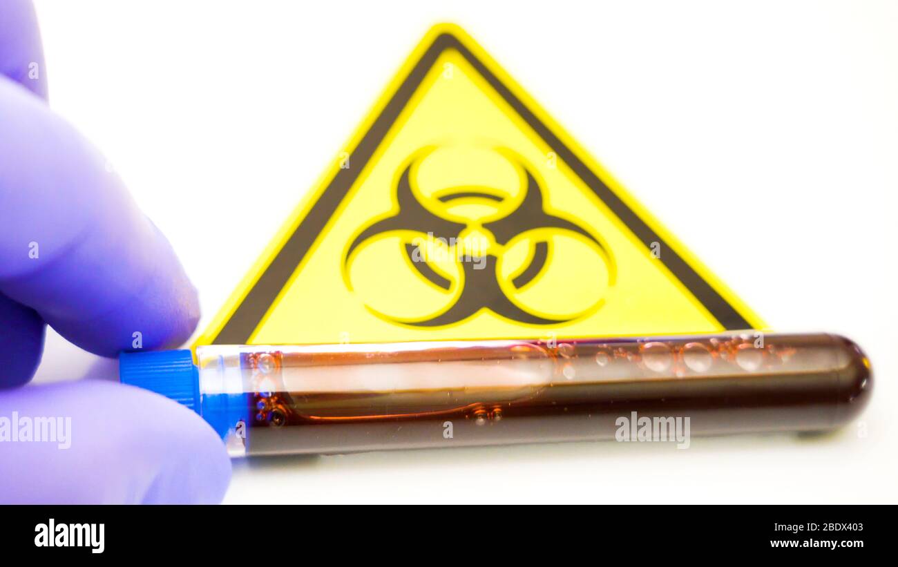 The yellow hazard sign with the blood sample kit on the table inside ...