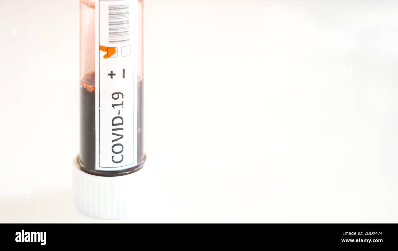 A small sample kit with the blood inside for coronavirus that tested ...