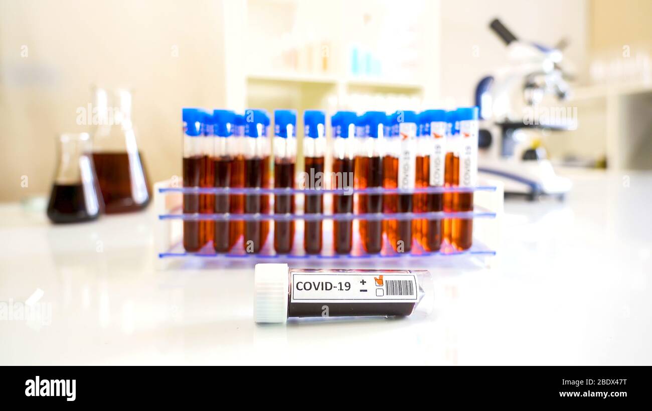 The small blood sample kit for coronavirus and the test tube rack on ...