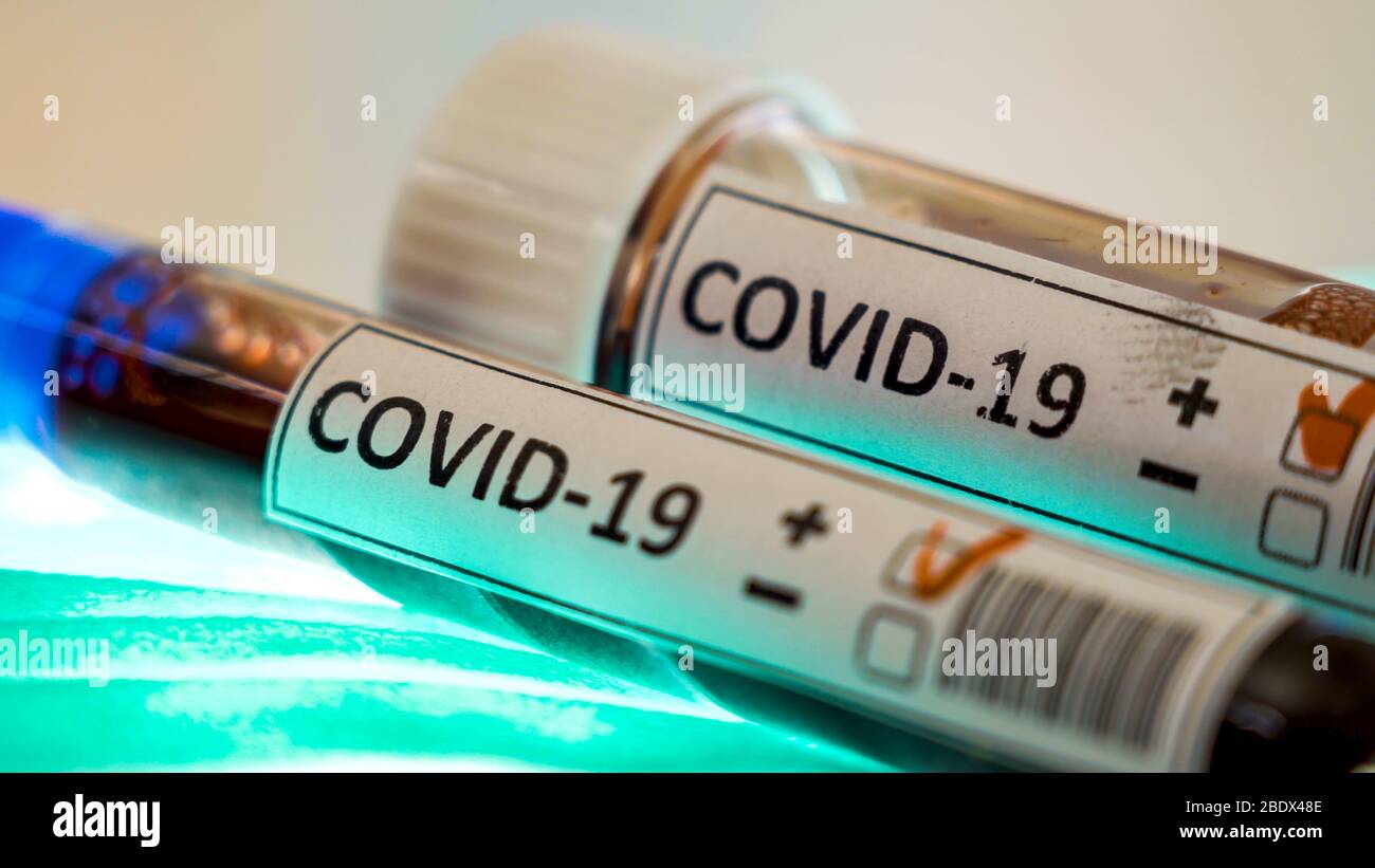 Two sample kits with coronavirus positive mark on the white table ...