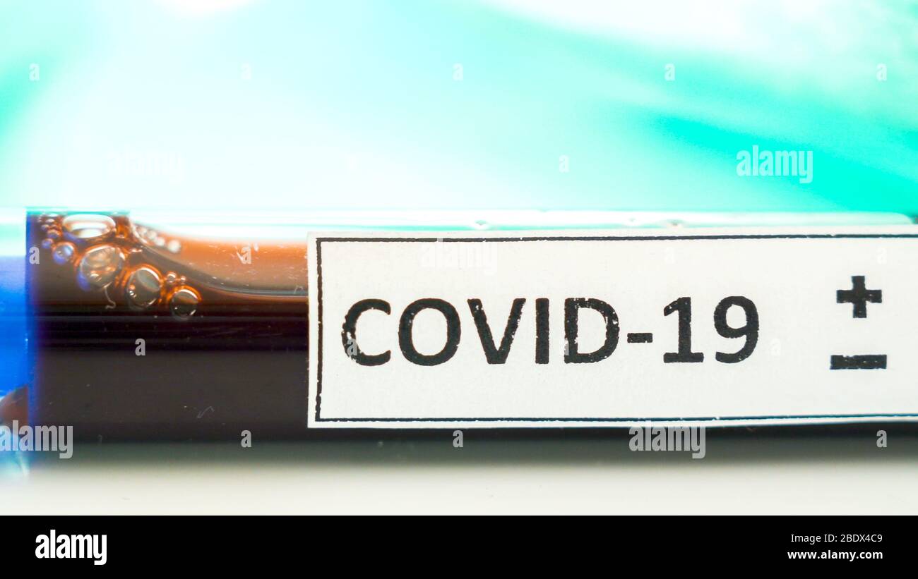 The sign for Covid-19 with the barcode on the sample kit for ...