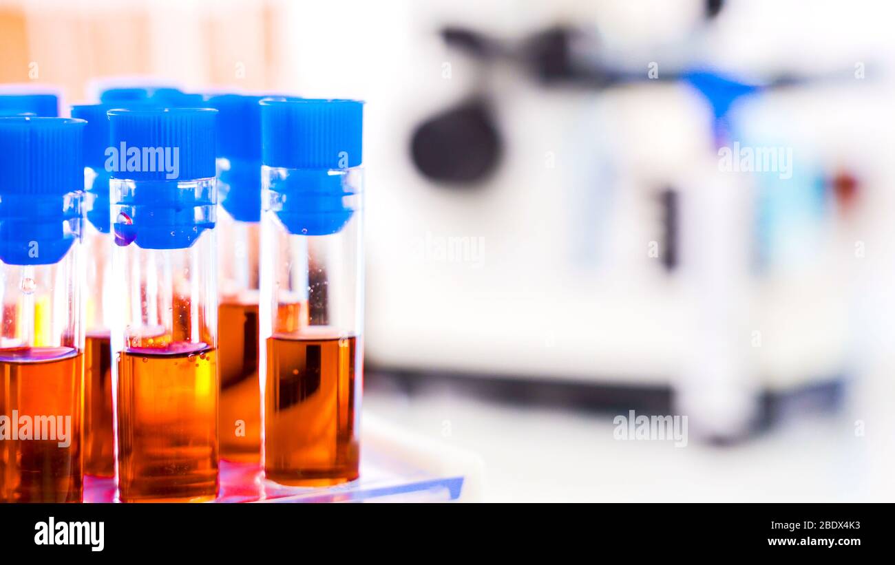 The samples on the test tubes and the coronavirus positive kit on the ...