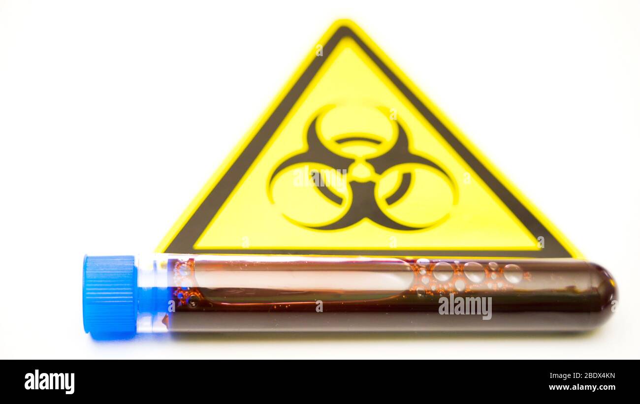 A look of the red blood sample inside the kit with the yellow hazard ...