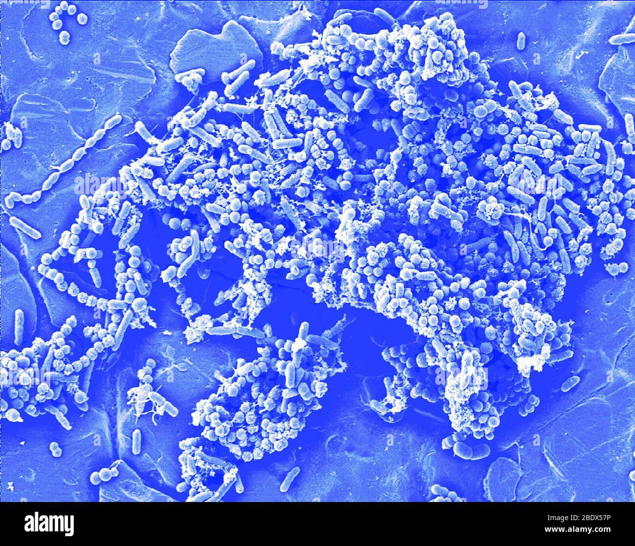 Magnified bacteria hi-res stock photography and images - Alamy