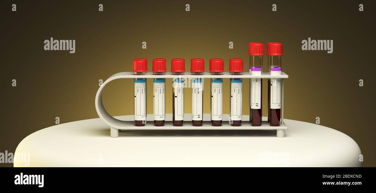 Blood samples testing screening hi-res stock photography and images - Alamy