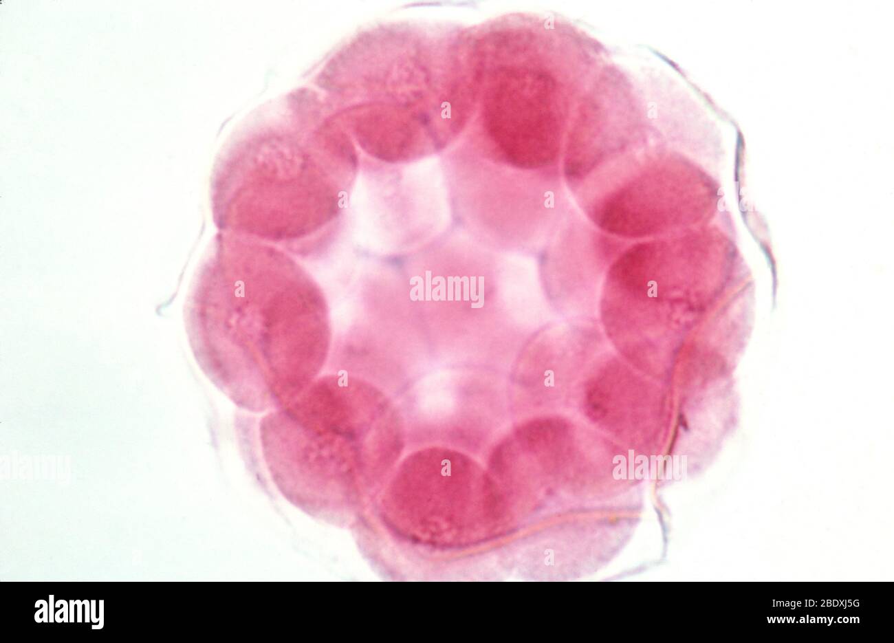 32 cell stage hi-res stock photography and images - Alamy