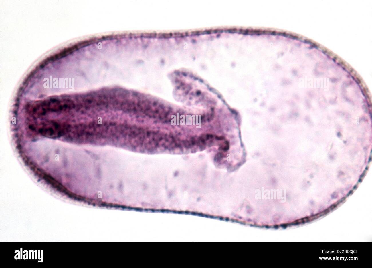Gastrula hi-res stock photography and images - Alamy