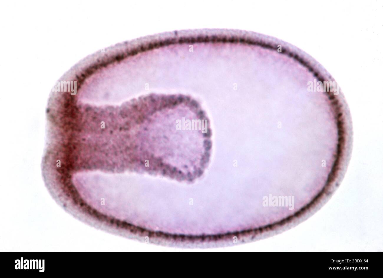 Archenteron hi-res stock photography and images - Alamy