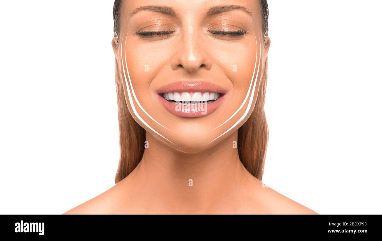 Close up portrait of woman with face-lifting lines on the face. Photo ...