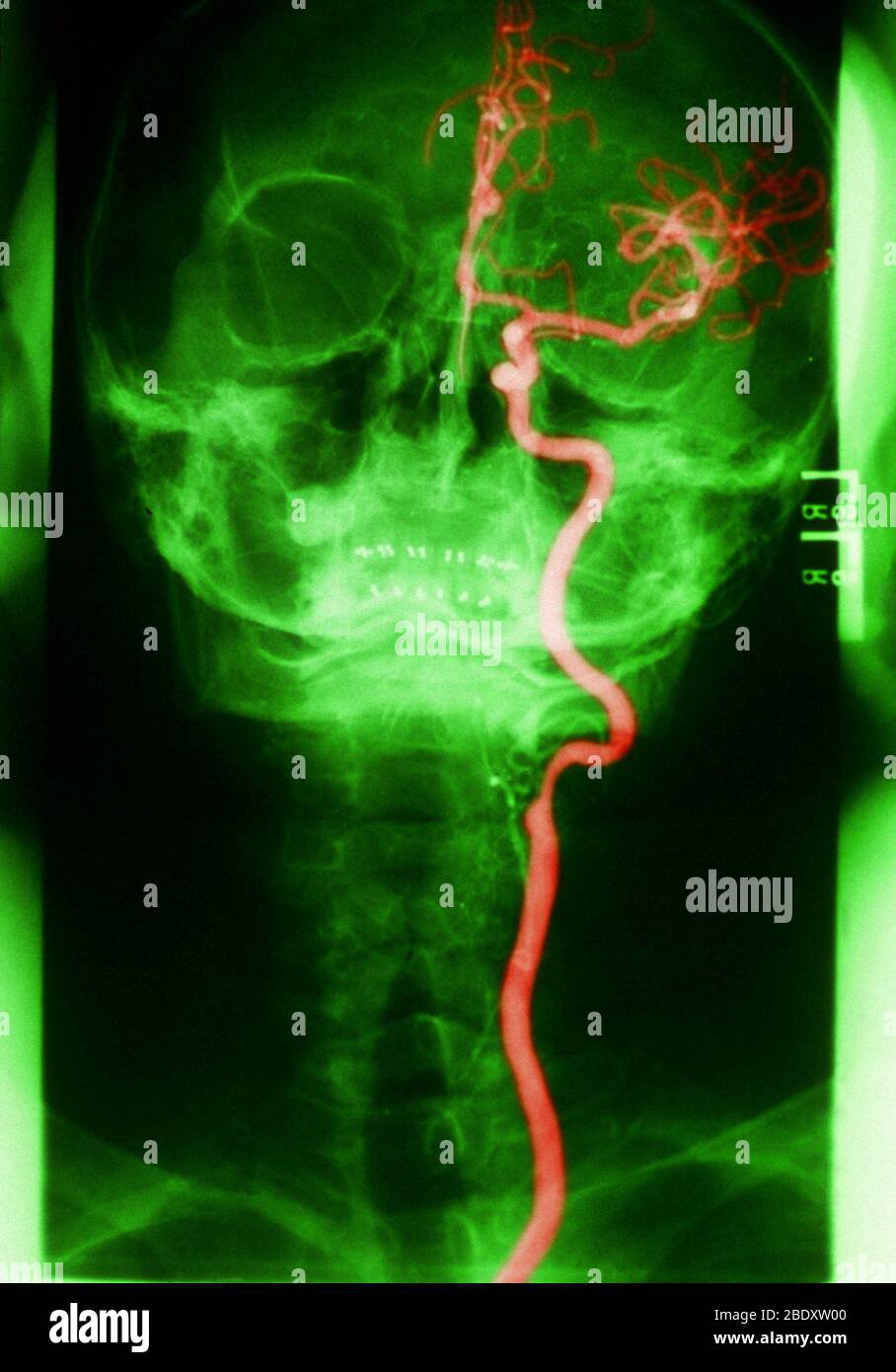 Circulatory system head hi-res stock photography and images - Alamy
