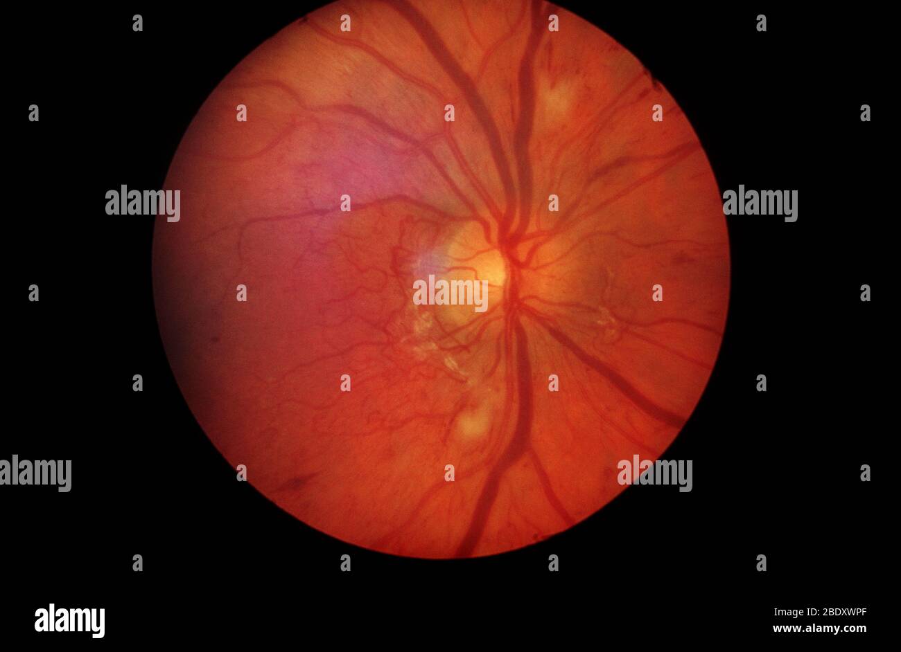 Fundus hi-res stock photography and images - Alamy