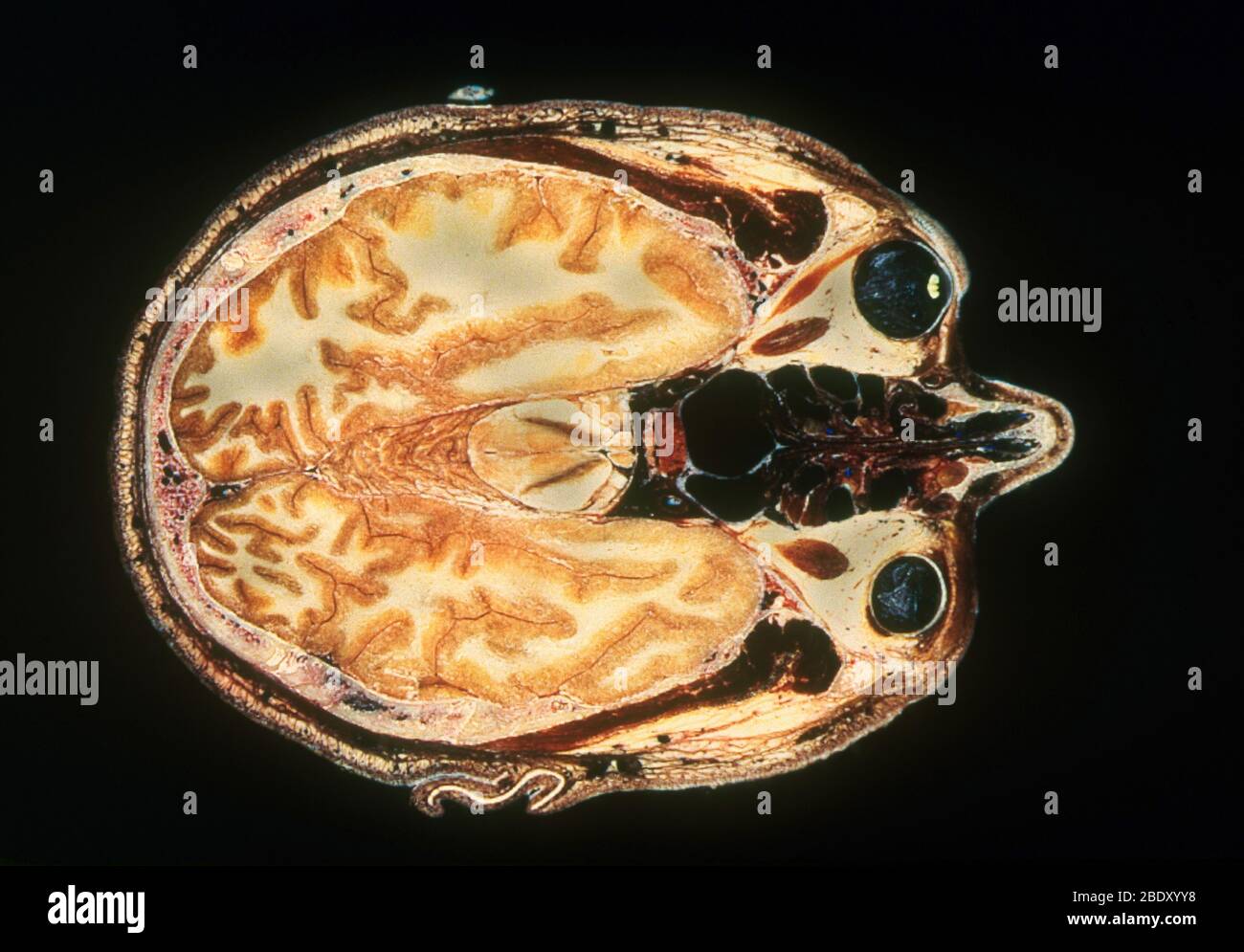 Human head brain anatomy hi-res stock photography and images - Alamy