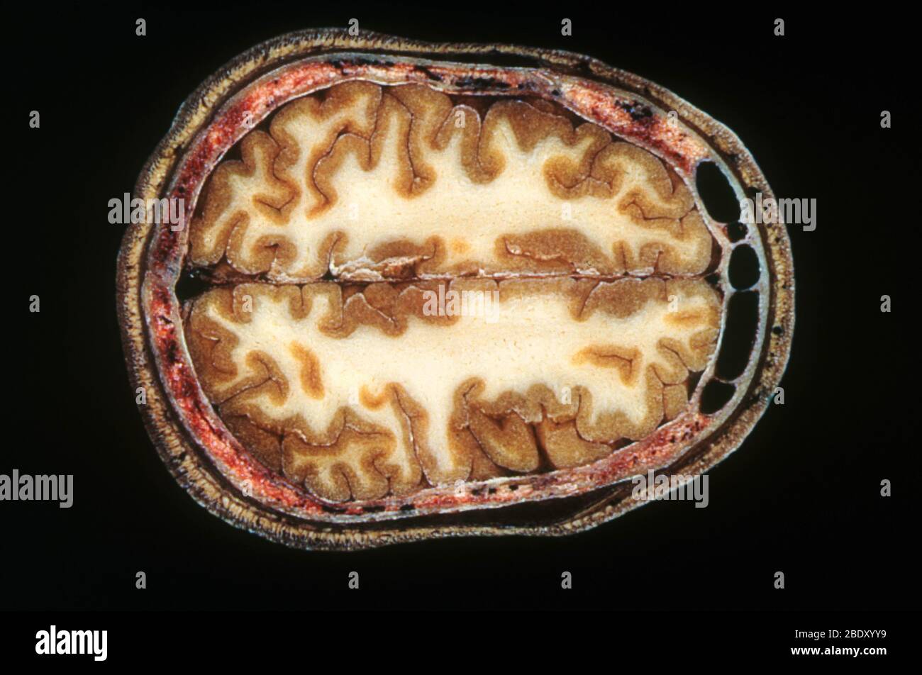 Anatomy specimen hi-res stock photography and images - Alamy