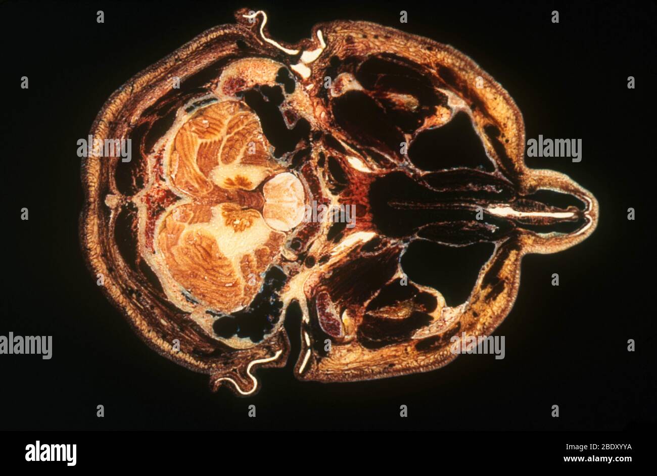 Human head anatomy hi-res stock photography and images - Alamy