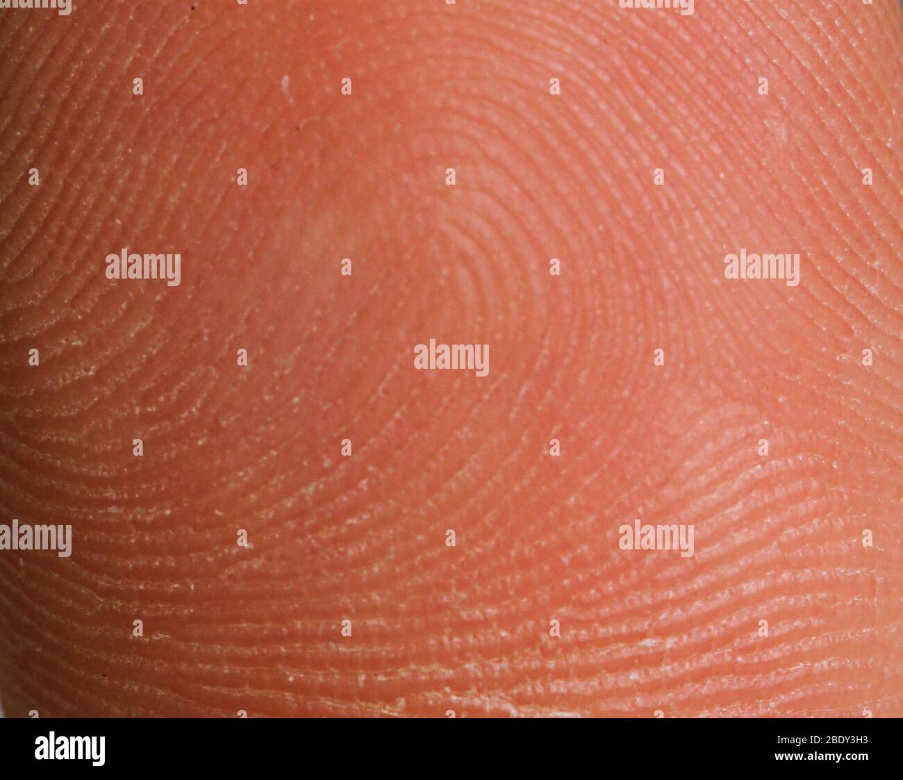 Identification characteristics hi-res stock photography and images - Alamy