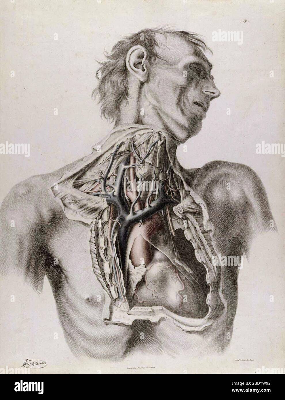 Historical Anatomical Illustration Stock Photo - Alamy