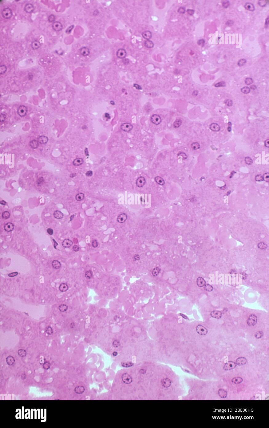 Liver Histology Model Labeled