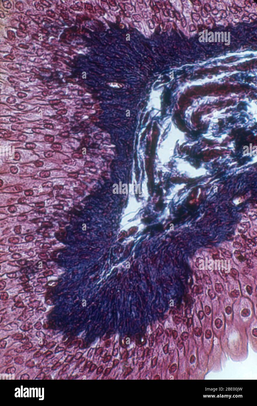 Excretory system hi-res stock photography and images - Alamy