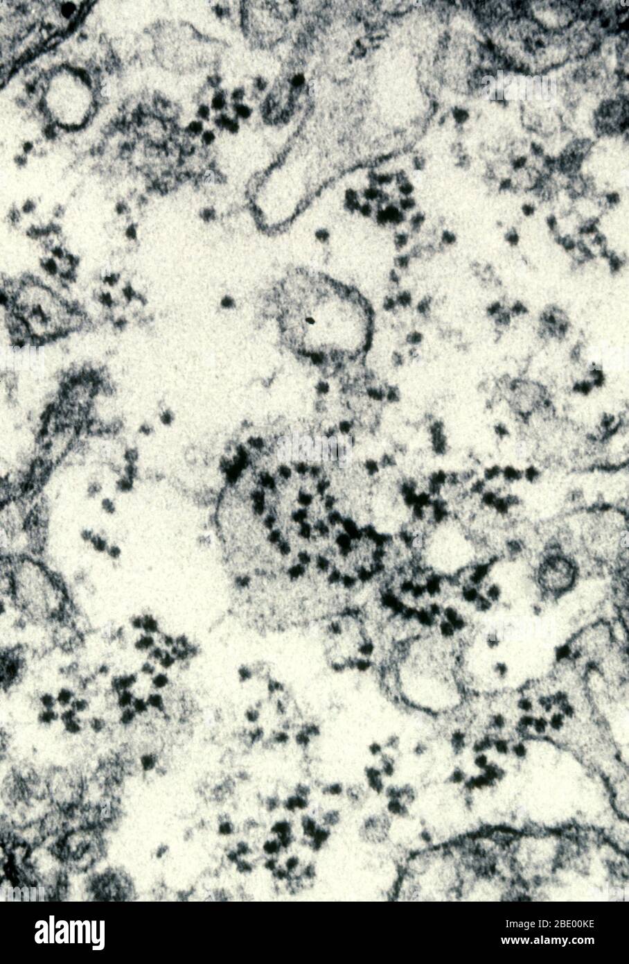 Polysome on endoplasmic reticulum hi-res stock photography and images ...