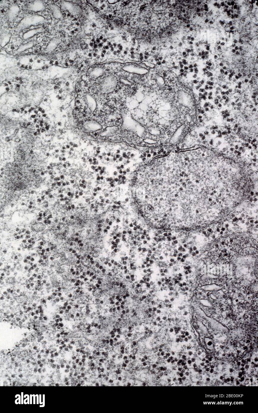 Ribosomes Microscope