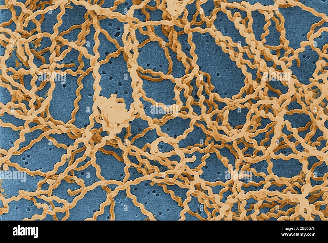Color enhanced Scanning Electron Micrograph (SEM) of Leptospira ...