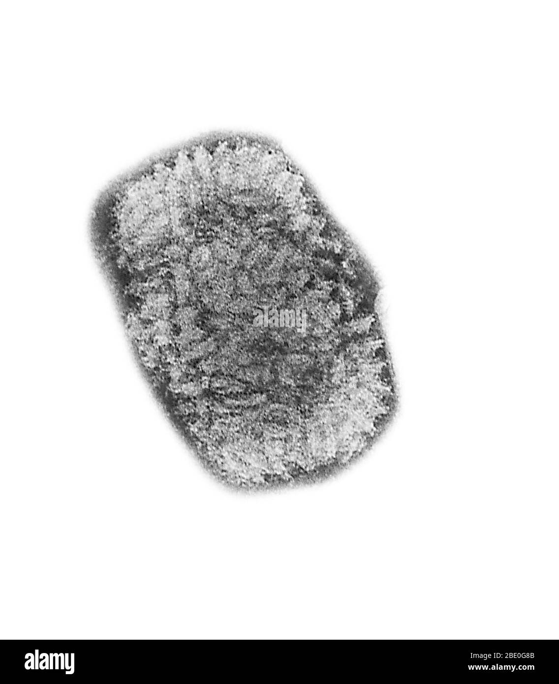 Smallpox virus microscope Black and White Stock Photos & Images - Alamy
