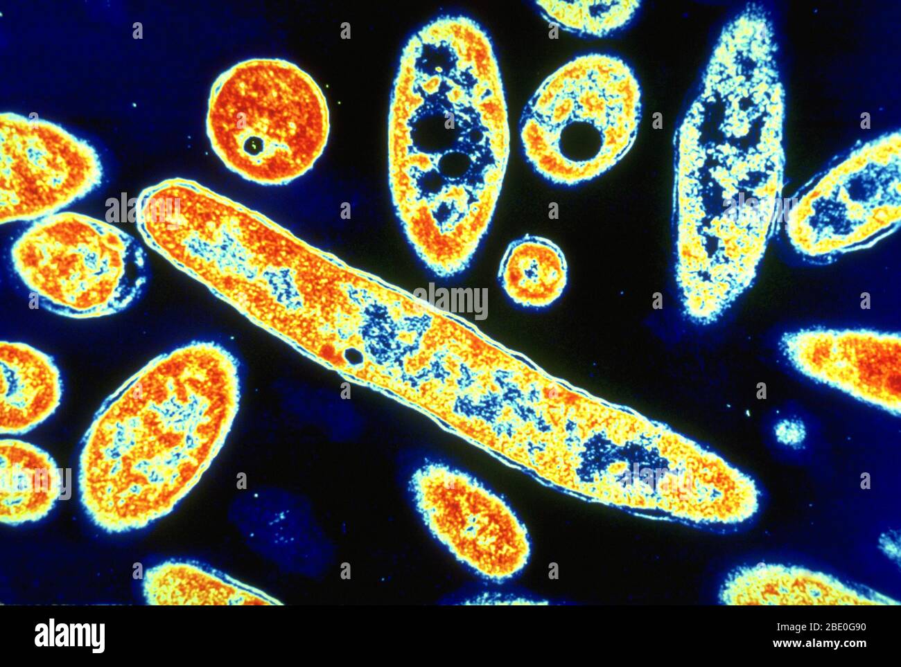 Color enhanced TEM of Legionnaires' disease bacteria (Legionella ...