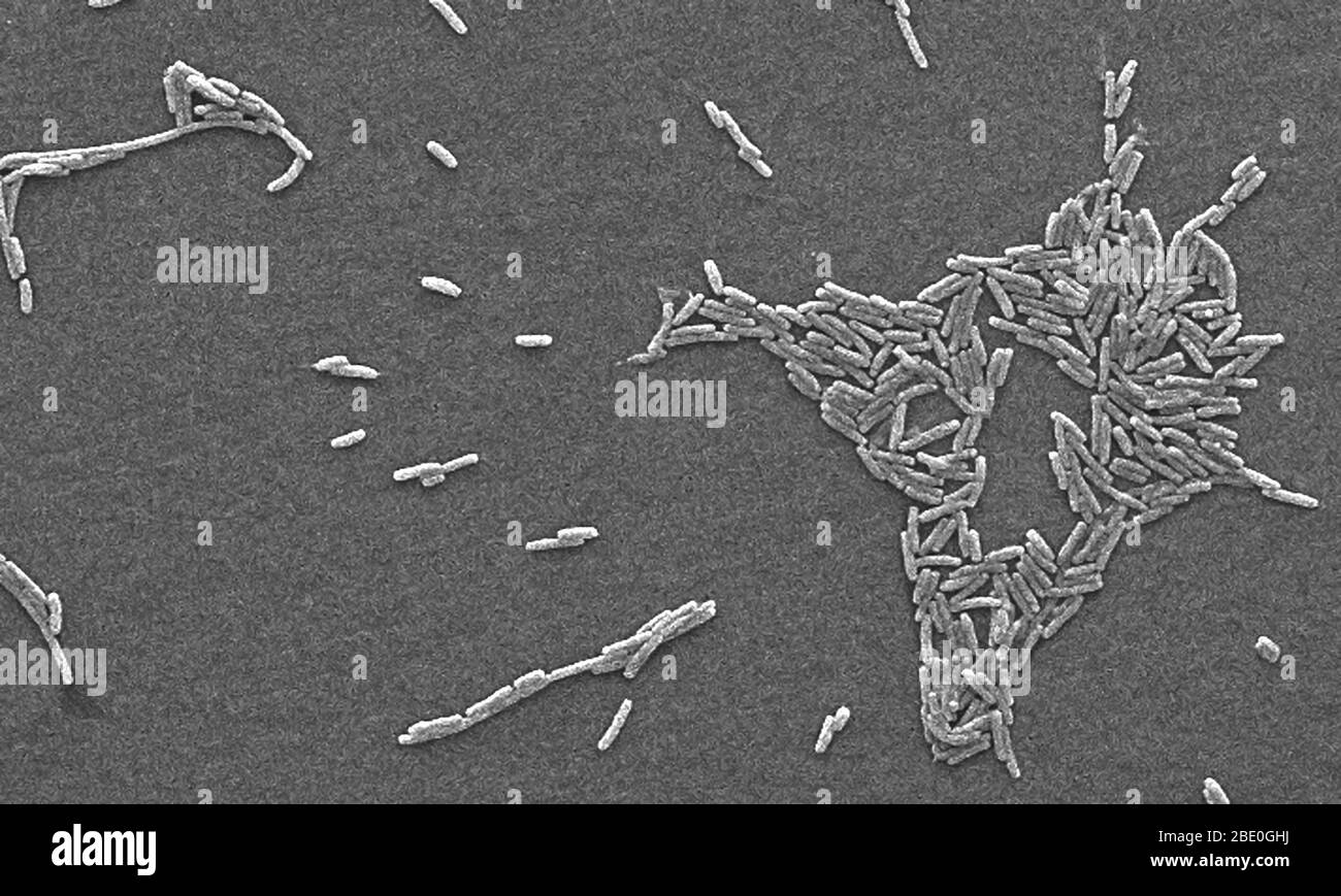 Scanning electron micrograph (SEM) of a number of a large grouping of ...