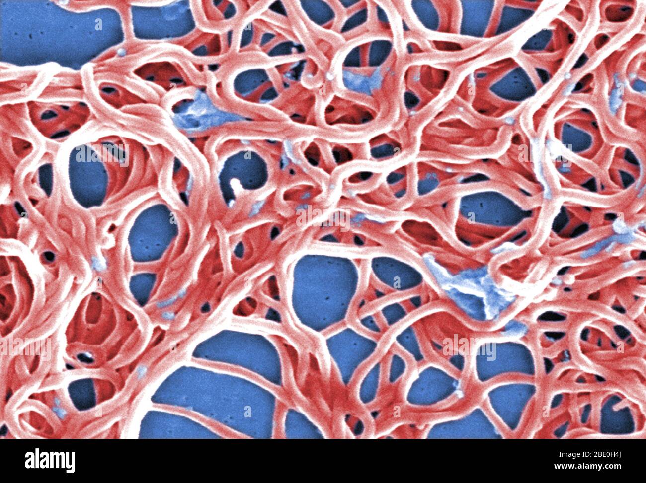 Spirochetes Gram Stain