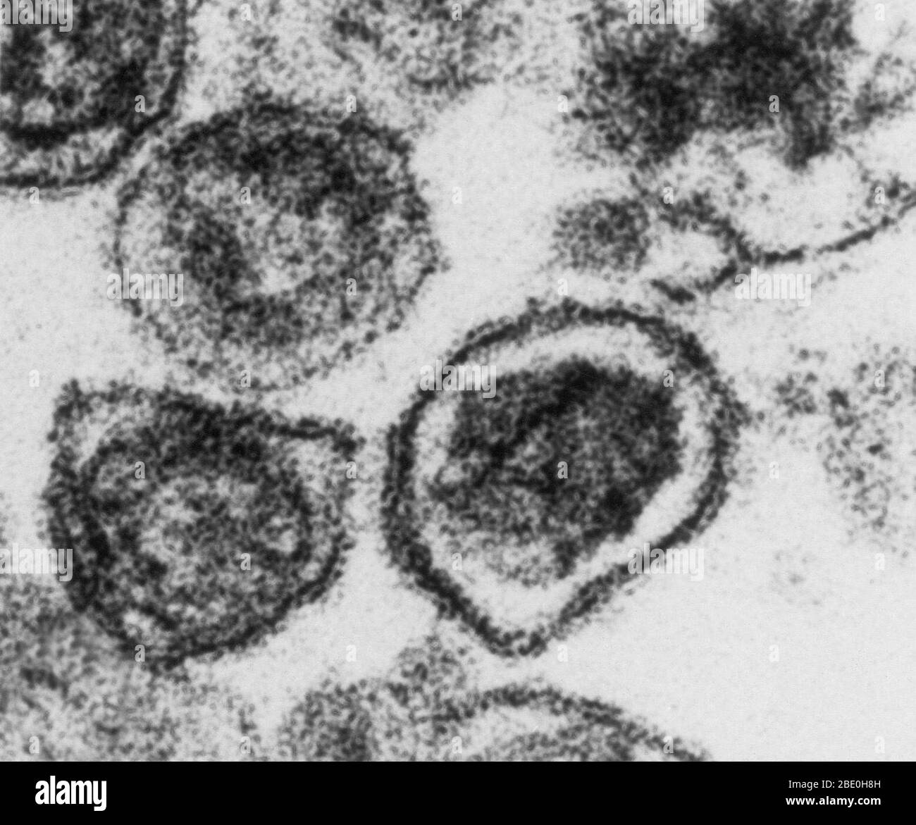 Transmission Electron Micrograph (TEM) of the HIV virus. The human ...
